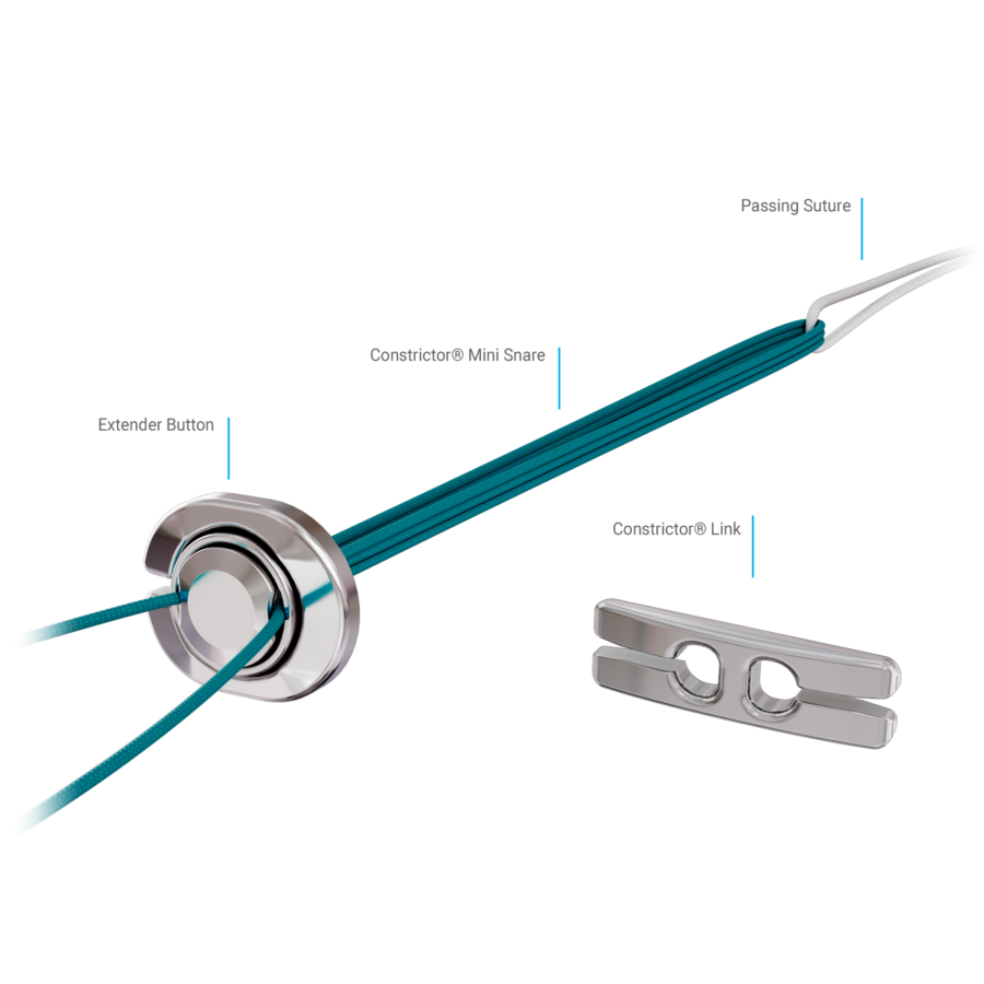Constrictor® Mini Snare for Lisfranc Repair