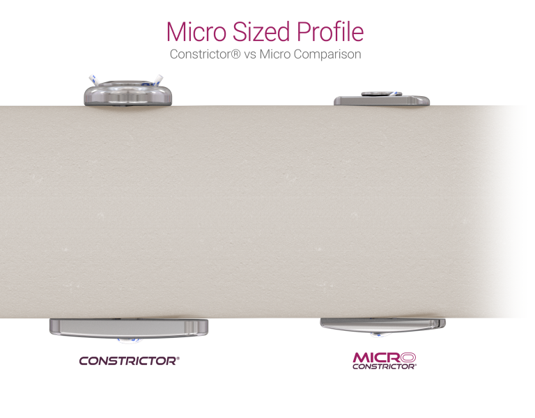 Micro-profile-comparison - Dunamis Medical