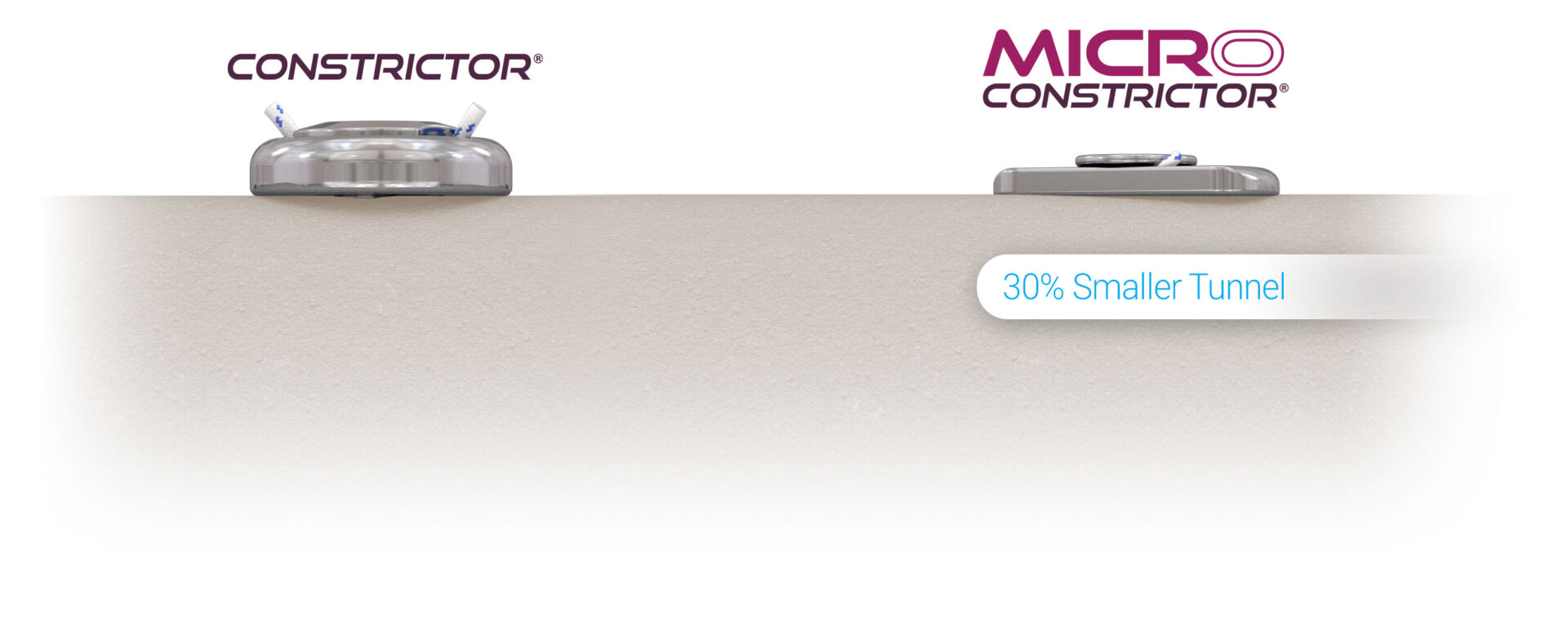 Micro Constrictor® for CMC Arthroplasty Repair | Dunamis Medical