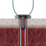 Constrictor® Mini Snare - Dunamis Medical