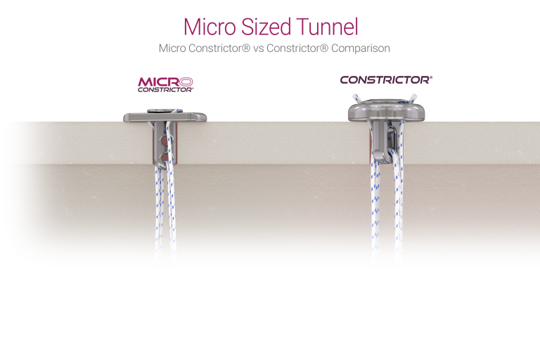 Micro Constrictor® - Dunamis Medical