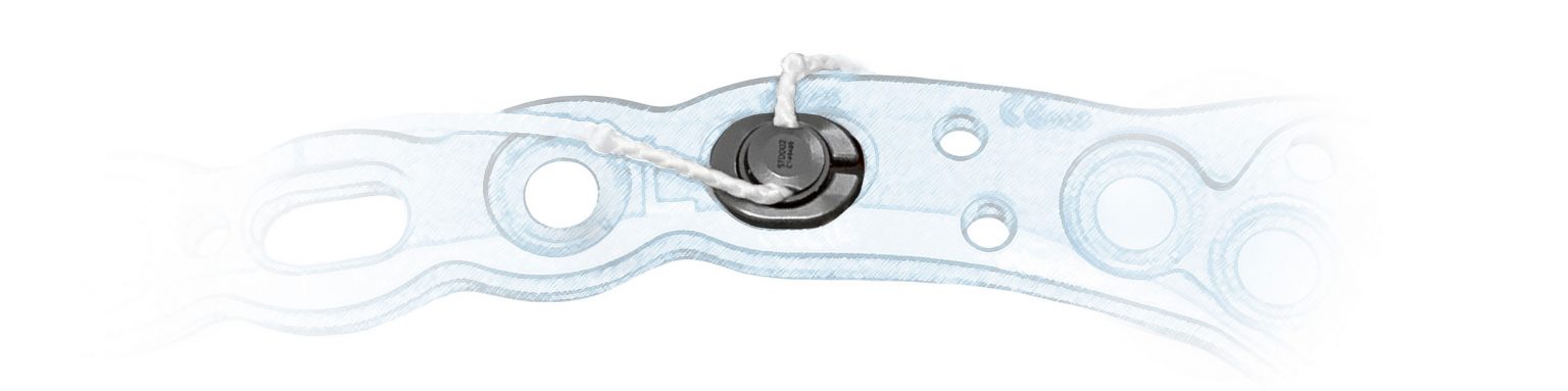 Button Extender for Constrictor Mini - Dunamis Medical